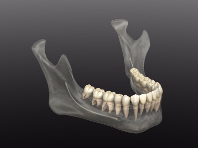 Four Solutions For Bone Loss That Make Dental Implants Possible